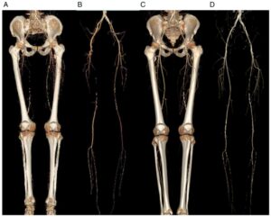 Computed Tomography – CT Scan – ScanLab Center