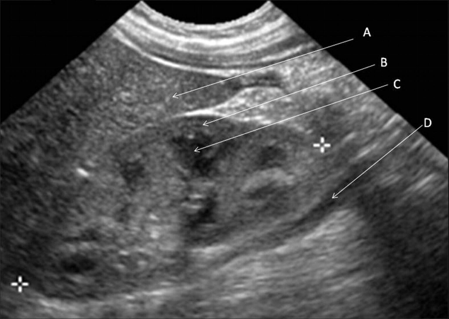 Ultrasound – ScanLab Center